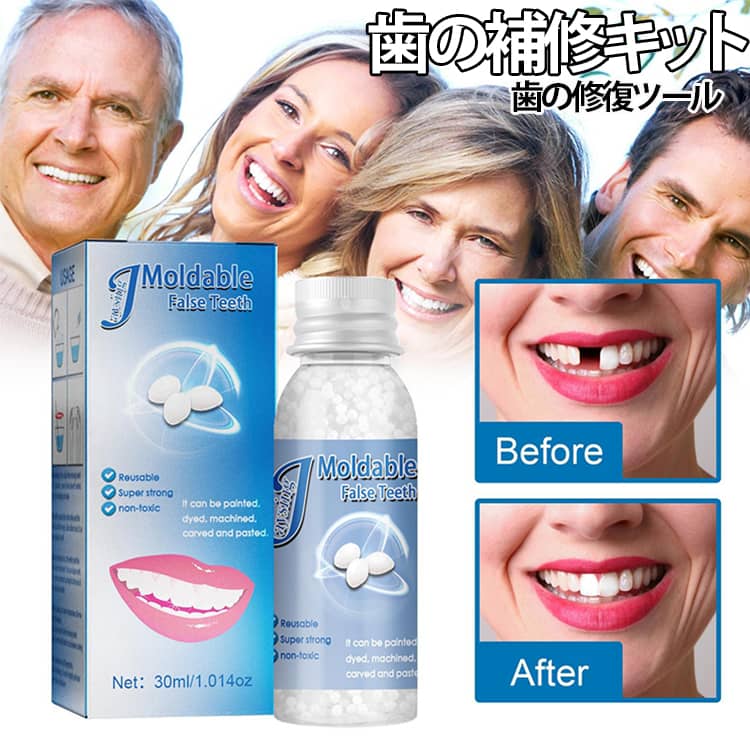 【一時的な歯の補修に】欠けた歯やすき間が気になるときに、応急的にカバーできる補修キット。見た目を自然に整えたい場面や、外出時のエチケット対策としても便利です。【お湯で簡単カスタマイズ】ぬるま湯に入れると柔らかくなり、自由に形を整えることが可...