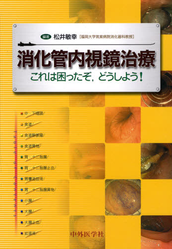 松井敏幸／編著本詳しい納期他、ご注文時はご利用案内・返品のページをご確認ください出版社名中外医学社出版年月2007年10月サイズ250P 26cmISBNコード9784498041660医学 臨床医学内科系 消化器一般消化管内視鏡治療 これ...