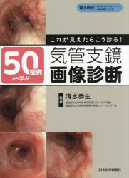 清水泰生／監修本詳しい納期他、ご注文時はご利用案内・返品のページをご確認ください出版社名日本医事新報社出版年月2026年03月サイズ126P 24cmISBNコード9784784902552医学 臨床医学内科系 呼吸器一般50症例から学ぶ!...