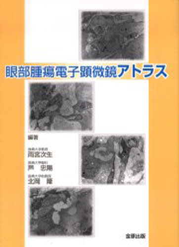 雨宮次生／編著 芦忠陽／編著 北岡隆／編著本詳しい納期他、ご注文時はご利用案内・返品のページをご確認ください出版社名金原出版出版年月2003年03月サイズ96P 31cmISBNコード9784307351096医学 臨床医学外科系 眼科学商...