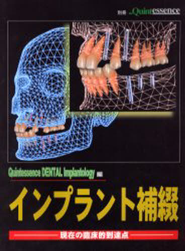 Quintessence Dental Implantology／編 赤川安正／〔ほか〕執筆別冊 the Quintessence本詳しい納期他、ご注文時はご利用案内・返品のページをご確認ください出版社名クインテッセンス出版出版年月2000...