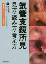 土田敬明／著本詳しい納期他、ご注文時はご利用案内・返品のページをご確認ください出版社名日本医事新報社出版年月2020年02月サイズ82P 26cmISBNコード9784784957507医学 臨床医学内科系 呼吸器一般商品説明気管支鏡所見 ...
