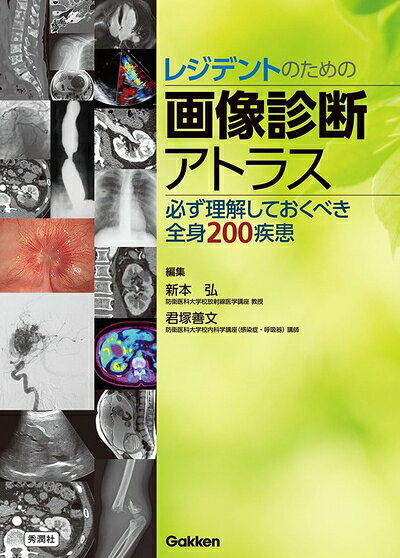 【お届け日について】お届け日の"指定なし"で、記載の最短日より早くお届けできる場合が多いです。お品物をなるべく早くお受け取りしたい場合は、お届け日を"指定なし"にてご注文ください。お届け日をご指定頂いた場合、ご注文後の変更はできかねます。【...