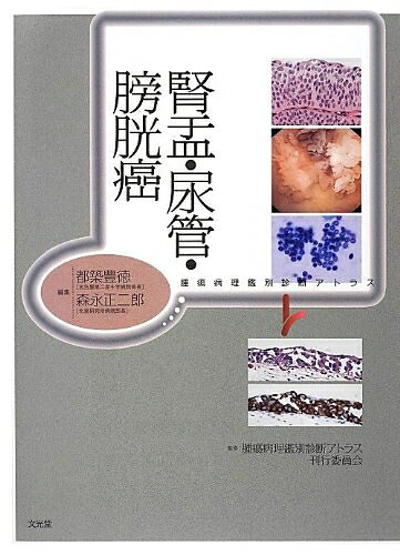 【お届け日について】お届け日の"指定なし"で、記載の最短日より早くお届けできる場合が多いです。お品物をなるべく早くお受け取りしたい場合は、お届け日を"指定なし"にてご注文ください。お届け日をご指定頂いた場合、ご注文後の変更はできかねます。【...