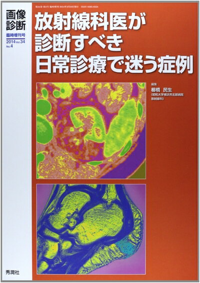 【お届け日について】お届け日の"指定なし"で、記載の最短日より早くお届けできる場合が多いです。お品物をなるべく早くお受け取りしたい場合は、お届け日を"指定なし"にてご注文ください。お届け日をご指定頂いた場合、ご注文後の変更はできかねます。【...