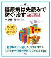 出荷目安の詳細はこちら内容詳細ひと目でわかるイラスト図解。糖尿病はドミノ倒しのように病気を起こす。タイプで違う合併症の現れ方と対処法を徹底解説！目次&nbsp;:&nbsp;1　糖尿病の将来はタイプで違う（これだけは知っておこう—糖尿病と診...