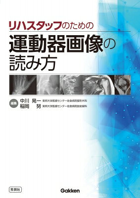 出荷目安の詳細はこちら内容詳細本書では運動器のリハビリで扱う頻度の高い疾患（約40疾患）にしぼり，画像の読み方を中心に放射線科医が分かりやすく解説する，その後スタッフが行う「リハビリのポイント・医師・スタッフへの報告，連携すべきポイントなど...