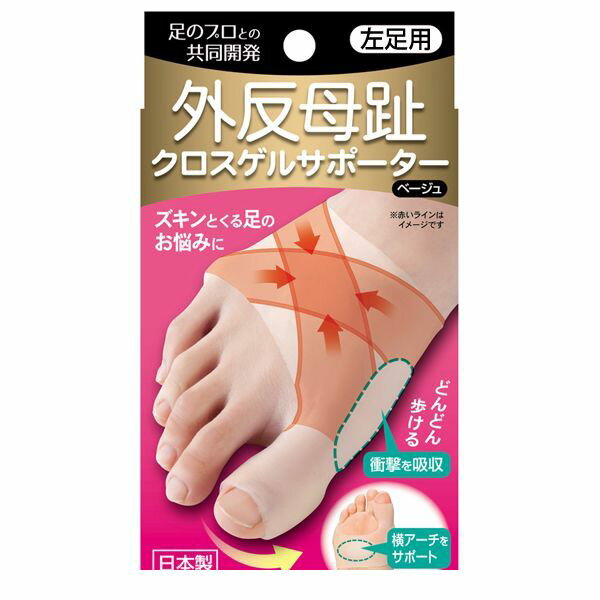 アルファックス06-4792-1193【商品説明】■クロスラインが親指をやさしく広げ、さらに親指横クッションが付け根のつらい摩擦や痛みをケアします。■同時に足裏のクッションが弛んだ横アーチを支え、足の負担を軽減します。■適応サイズ／重量（約...
