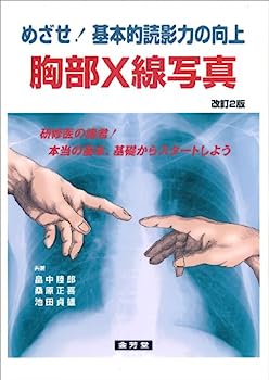 【中古】胸部X線写真—めざせ!基本的読影力の向上【メーカー名】【メーカー型番】【ブランド名】【商品説明】胸部X線写真—めざせ!基本的読影力の向上こちらの商品は中古品となっております。 画像はイメージ写真ですので 商品のコンディション・付属品...