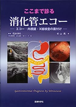 【中古】ここまで診る消化管エコー —エコー・内視鏡・X線検査の裏付け【メーカー名】医療科学社【メーカー型番】【ブランド名】【商品説明】ここまで診る消化管エコー —エコー・内視鏡・X線検査の裏付け杉山 高当店では初期不良に限り、商品到着から7...