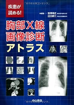 【中古】疾患が読める! 胸部X線画像診断アトラス【メーカー名】中山書店【メーカー型番】【ブランド名】【商品説明】疾患が読める! 胸部X線画像診断アトラス吉澤靖之当店では初期不良に限り、商品到着から7日間は返品を 受付けております。お問い合わ...
