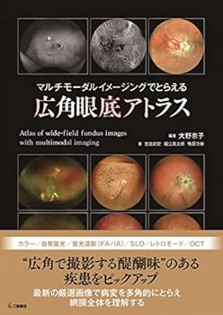 【中古】マルチモーダルイメージングでとらえる 広角眼底アトラス【メーカー名】三輪書店【メーカー型番】【ブランド名】三輪書店【商品説明】マルチモーダルイメージングでとらえる 広角眼底アトラス大野京子当店では初期不良に限り、商品到着から7日間は...