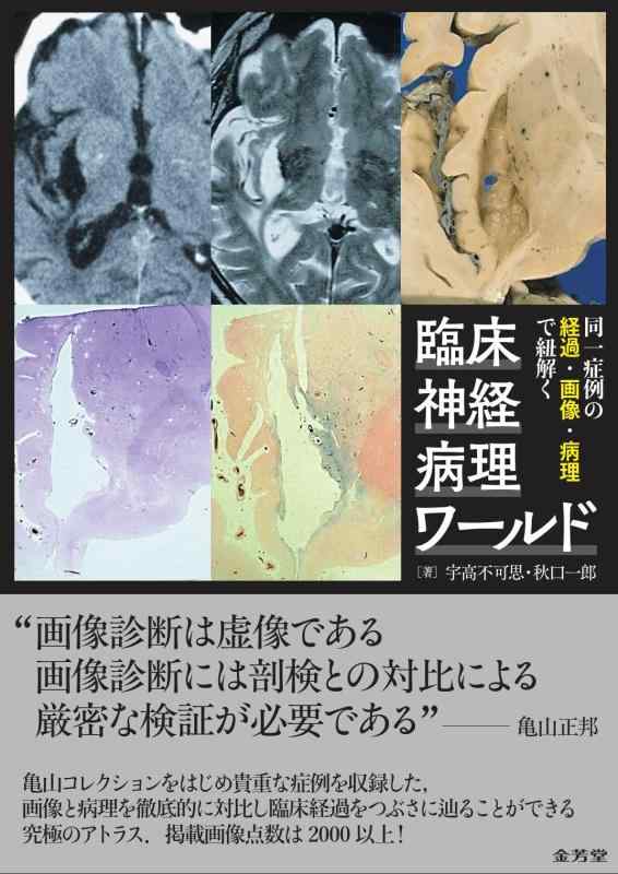 同一症例の経過・画像・病理で紐解く 臨床神経病理ワールド【 ご注文確定のタイミングについて 】 商品は他サイトでも販売しているため、在庫反映にタイムラグが生じる場合がございます。入れ違いで完売となった際は、速やかにメールでご連絡の上、キャン...