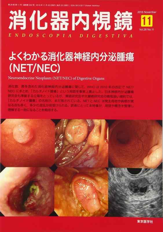 消化器内視鏡第28巻11号 よくわかる消化器神経内分泌腫瘍(NET/NEC)【 ご注文確定のタイミングについて 】 商品は他サイトでも販売しているため、在庫反映にタイムラグが生じる場合がございます。入れ違いで完売となった際は、速やかにメール...