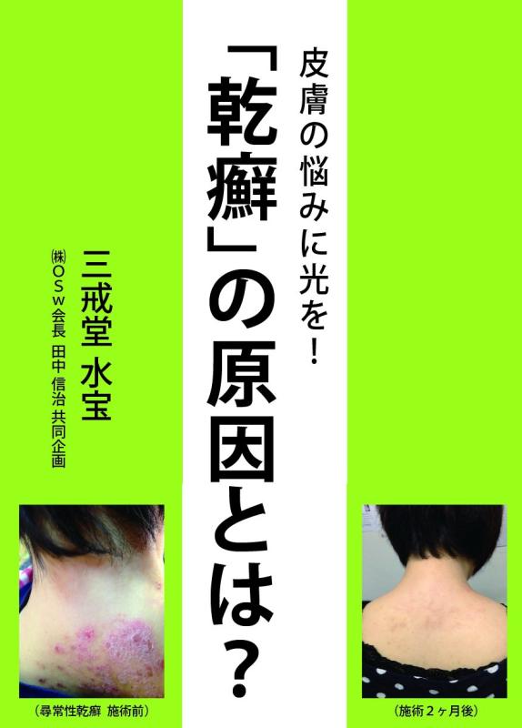 皮膚の悩みに光を 「乾癬」の原因とは?【 ご注文確定のタイミングについて 】 商品は他サイトでも販売しているため、在庫反映にタイムラグが生じる場合がございます。入れ違いで完売となった際は、速やかにメールでご連絡の上、キャンセルのお手続きをさ...