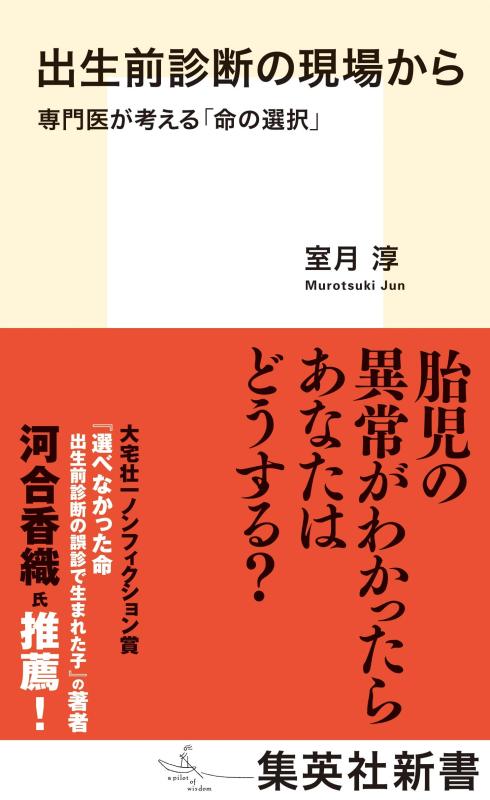 出生前診断の現場から 専門医が考える「命の選択」 (集英社新書)【 ご注文確定のタイミングについて 】 商品は他サイトでも販売しているため、在庫反映にタイムラグが生じる場合がございます。入れ違いで完売となった際は、速やかにメールでご連絡の上...