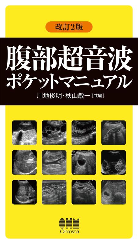 腹部超音波ポケットマニュアル(改訂2版)【 ご注文確定のタイミングについて 】 商品は他サイトでも販売しているため、在庫反映にタイムラグが生じる場合がございます。入れ違いで完売となった際は、速やかにメールでご連絡の上、キャンセルのお手続きを...