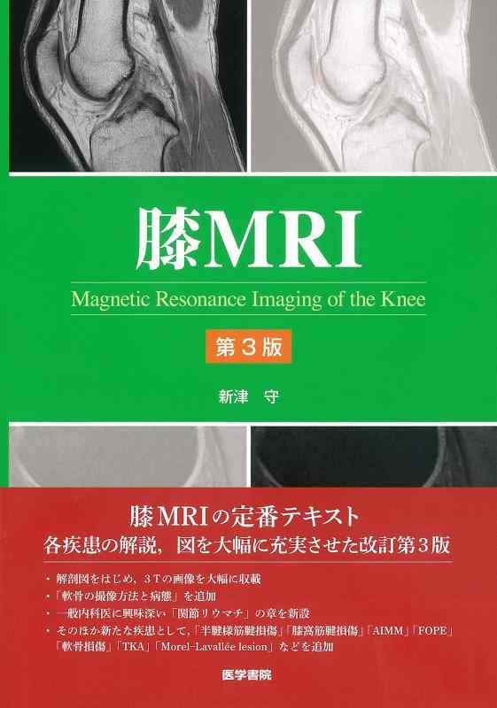 膝MRI 第3版【 ご注文確定のタイミングについて 】 商品は他サイトでも販売しているため、在庫反映にタイムラグが生じる場合がございます。入れ違いで完売となった際は、速やかにメールでご連絡の上、キャンセルのお手続きをさせていただきます。 【...