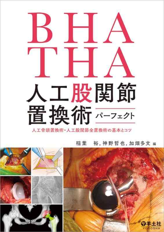 BHA・THA 人工股関節置換術パーフェクト〜人工骨頭置換術・人工股関節全置換術の基本とコツ【 ご注文確定のタイミングについて 】 商品は他サイトでも販売しているため、在庫反映にタイムラグが生じる場合がございます。入れ違いで完売となった際は...