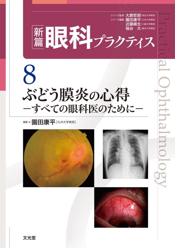 ぶどう膜炎の心得 (新篇眼科プラクティス 8)【 ご注文確定のタイミングについて 】 商品は他サイトでも販売しているため、在庫反映にタイムラグが生じる場合がございます。入れ違いで完売となった際は、速やかにメールでご連絡の上、キャンセルのお手...
