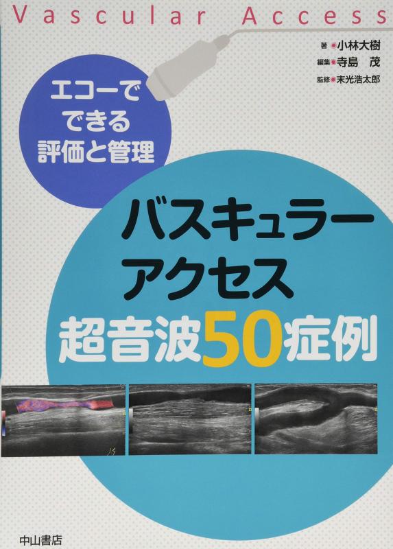 エコーでできる評価と管理 バスキュラーアクセス超音波50症例【 ご注文確定のタイミングについて 】 商品は他サイトでも販売しているため、在庫反映にタイムラグが生じる場合がございます。入れ違いで完売となった際は、速やかにメールでご連絡の上、キ...
