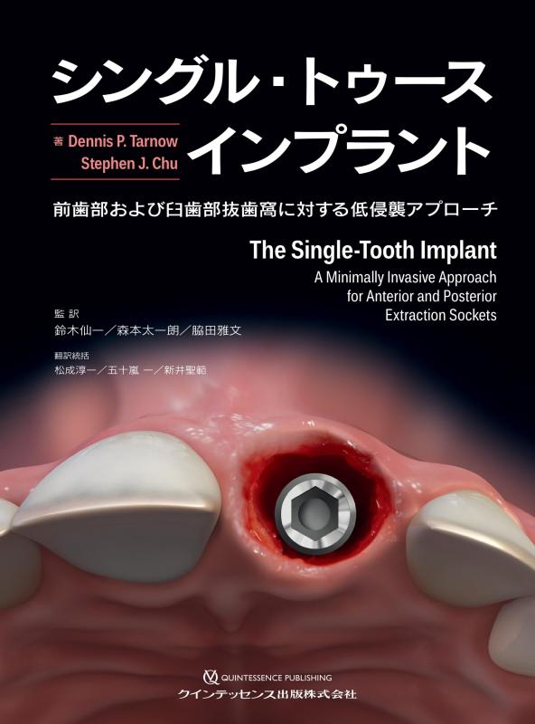 シングル・トゥースインプラント: 前歯部および臼歯部抜歯窩に対する低侵襲アプローチ【 ご注文確定のタイミングについて 】 商品は他サイトでも販売しているため、在庫反映にタイムラグが生じる場合がございます。入れ違いで完売となった際は、速やかに...