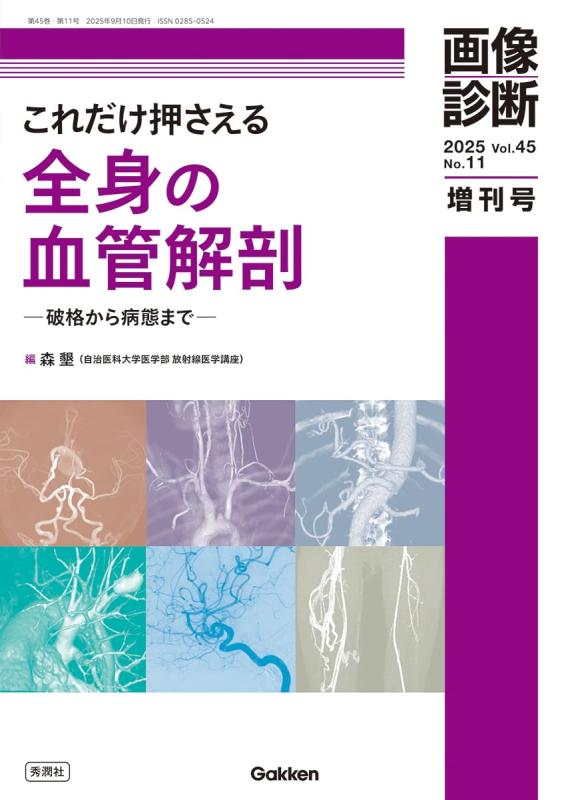画像診断2025年増刊号Vol.45 No.11: これだけ押さえる全身の血管解剖 ―破格から病態まで― (画像診断増刊号 2025(Vol.45 No.11))【 ご注文確定のタイミングについて 】 商品は他サイトでも販売しているため、在...