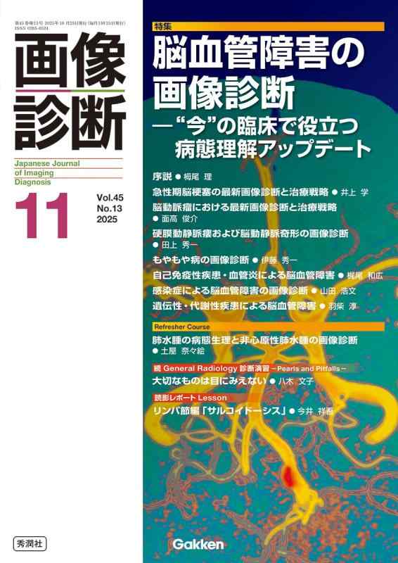画像診断2025年11月号 Vol.45 No.13: 脳血管障害の画像診断 ―”今”の臨床で役立つ病態理解アップデート【 ご注文確定のタイミングについて 】 商品は他サイトでも販売しているため、在庫反映にタイムラグが生じる場合がございます...