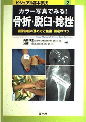 カラー写真でみる骨折・脱臼・捻挫: 画像診断の進め方と整復・固定のコツ (ビジュアル基本手技 2)【 ご注文確定のタイミングについて 】 商品は他サイトでも販売しているため、在庫反映にタイムラグが生じる場合がございます。入れ違いで完売となっ...