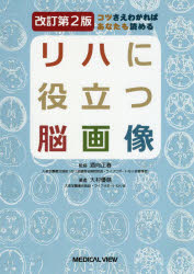 大村優慈／著 酒向正春／監修本詳しい納期他、ご注文時はご利用案内・返品のページをご確認ください出版社名メジカルビュー社出版年月2020年10月サイズ189P 26cmISBNコード9784758320139医学 臨床医学外科系 リハビリテー...