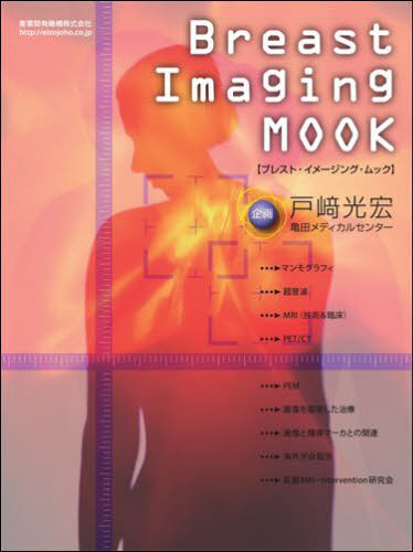 戸崎光宏／企画本詳しい納期他、ご注文時はご利用案内・返品のページをご確認ください出版社名産業開発機構出版年月2010年03月サイズ152P 28cmISBNコード9784903940410医学 臨床医学一般 画像診断・超音波診断学Breas...