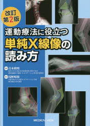 浅野昭裕／著 青木隆明／監修本詳しい納期他、ご注文時はご利用案内・返品のページをご確認ください出版社名メジカルビュー社出版年月2022年11月サイズ453P 26cmISBNコード9784758320825医学 臨床医学外科系 リハビリテー...