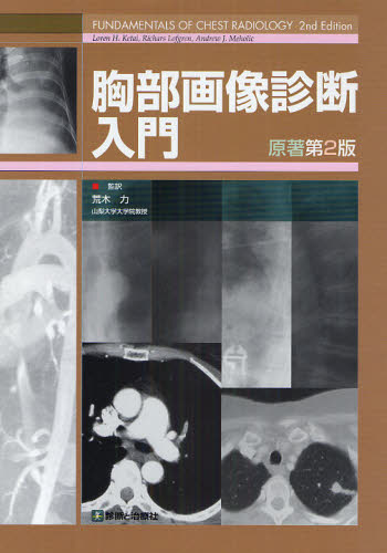 Loren H.Ketai／〔著〕 Richard Lofgren／〔著〕 Andrew J.Meholic／〔著〕 荒木力／監訳本詳しい納期他、ご注文時はご利用案内・返品のページをご確認ください出版社名診断と治療社出版年月2009年06月...