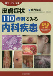 出光俊郎／編本詳しい納期他、ご注文時はご利用案内・返品のページをご確認ください出版社名日本医事新報社出版年月2018年09月サイズ242P 30cmISBNコード9784784957200医学 臨床医学内科系 皮膚科学皮膚症状110症例でみ...