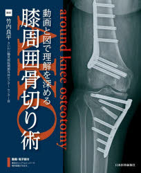 竹内良平／編本詳しい納期他、ご注文時はご利用案内・返品のページをご確認ください出版社名日本医事新報社出版年月2022年12月サイズ135P 26cmISBNコード9784784969500医学 臨床医学外科系 整形外科学動画と図で理解を深め...