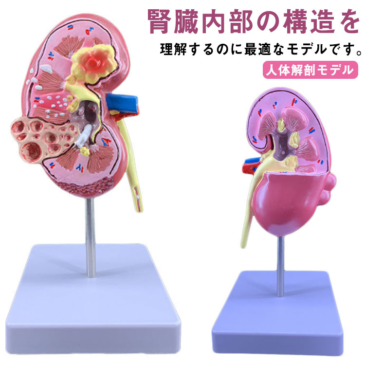 腎臓内部の構造を理解するのに最適なモデルです。医療現場での患者さんへの説明用に使える可能です!解剖学による生徒への説明や医療現場での患者さんへの説明用に使える模型です。 サイズ 総高さ23cm サイズについての説明 模型高さ16cm 総高さ...