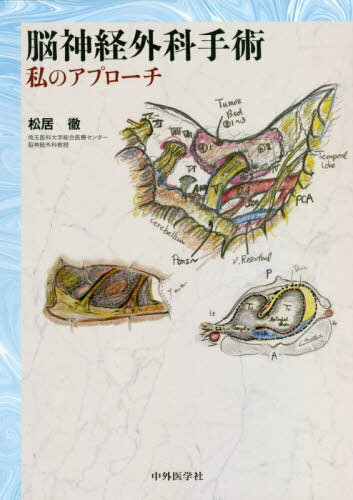 ご注文前に必ずご確認ください＜商品説明＞選び抜かれた手術例がエキスパートの理念を伝える。著者自身のイラストレーションにより、「経験に裏打ちされたテクニック」と「病巣へのアプローチ」の極意が浮かびあがる。＜収録内容＞第1章 脳動脈瘤第2章 脳...