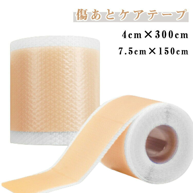 【傷あとケアテープ】4cm×300cm7.5cm×150cm【手術後の傷あとをしっかりキレイに守る】肌にやさしいシリコンテープ採用【伸展刺激の抑制】伸縮性の強いシリコンテープだから傷あとが伸びるのを防ぎます。【摩擦刺激の軽減】衣類や下着のこ...