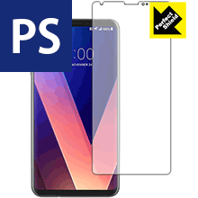 ※対応機種 : LG V30 / LG V30+ ※製品内容 : 前面用1枚※写真はイメージです。「Perfect Shield」は画面の反射を抑え、指のすべりもなめらかな指紋や皮脂汚れがつきにくい『アンチグレアタイプ(非光沢)の液晶保護フ...