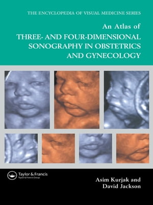 ＜p＞The use of three-dimensional ultrasound has expanded, particularly in obstetrics and gynecology clinical practice, ne...