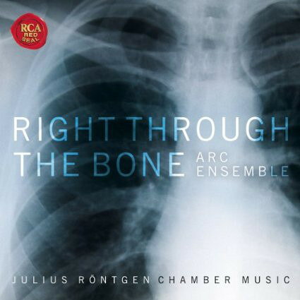 ・アーティスト Julius R?ntgen, David Louie; Dianne Werner ・タイトル Right Through the Bone (Snys) ・レーベル・型番 RCA Red Seal 88697158372...