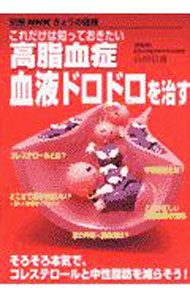 &nbsp;&nbsp;&nbsp; これだけは知っておきたい高脂血症血液ドロドロを治す 単行本 の詳細 出版社: 日本放送出版協会 レーベル: 別冊NHKきょうの健康 作者: 山田信博 カナ: コレダケワシッテオキタイコウシケツショウケツ...
