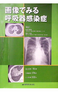 &nbsp;&nbsp;&nbsp; 画像でみる呼吸器感染症 単行本 の詳細 出版社: 国際医学出版 レーベル: 作者: 松島敏春 カナ: ガゾウデミルコキュウキカンセンショウ / マツシマトシハル サイズ: 単行本 ISBN: 48610...