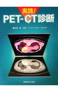 &nbsp;&nbsp;&nbsp; 実践！PET−CT診断 単行本 の詳細 出版社: メジカルビュー社 レーベル: 作者: 巽光朗【編著】 カナ: ジッセンペットシーティーシンダン / タツミミツアキ サイズ: 単行本 ISBN: 978...