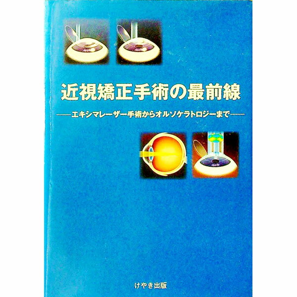 &nbsp;&nbsp;&nbsp; 近視矯正手術の最前線 単行本 の詳細 出版社: けやき出版 レーベル: 作者: 宇佐美脩 カナ: キンシキョウセイシュジュツノサイゼンセン / ウサミオサム サイズ: 単行本 ISBN: 9784877...
