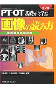 &nbsp;&nbsp;&nbsp; PT・OT基礎から学ぶ画像の読み方 単行本 の詳細 実際に臨床で使用された単純X線、X線CT、MRIの画像を掲載し、正常画像と病的画像を比較しながら読み方を易しく説明する。国家試験の画像問題と別冊の解答...