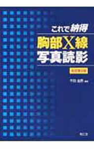 &nbsp;&nbsp;&nbsp; これで納得胸部X線写真読影 単行本 の詳細 胸部単純X線写真の読影の基礎と基本を、初学者にもわかりやすいよう解説。画像解析の基準に数値化したものを導入し、読影の手順を局所解剖に従って分割して提示。X線写...