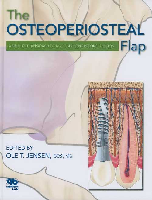 タイトル: Osteoperiosteal Flap: A Simplified Approach to Alveolar Bone Reconstruction著者: OLE T Jensen Ed.出版社: Quintessence P...
