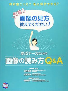 【中古】学ぶナースのための画像の読み方Q&A 先輩!画像の見方教えてください!【メーカー名】【メーカー型番】【ブランド名】【商品説明】学ぶナースのための画像の読み方Q&A 先輩!画像の見方教えてください!画像はサンプル写真のため商品のコンデ...