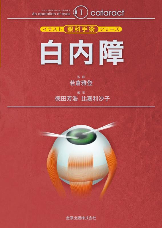 白内障 (イラスト眼科手術シリーズ 1)■ ご購入前に必ずご確認ください ■1. 在庫管理とご注文の確定当店は複数のオンラインモールで在庫を共有しております。在庫の変動： 更新のタイムラグにより、ご注文後に「完売」が判明する場合がございます...